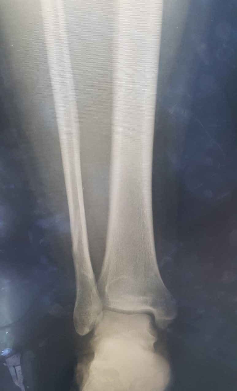 응급의학과 전문의 닥터K : 네이버 블로그