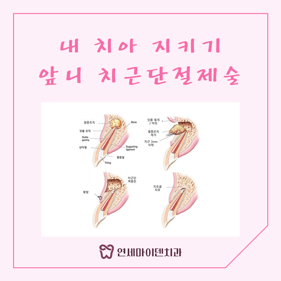 연세마이덴치과 세브란스본원출신 치과전문의 협진 네이버 블로그