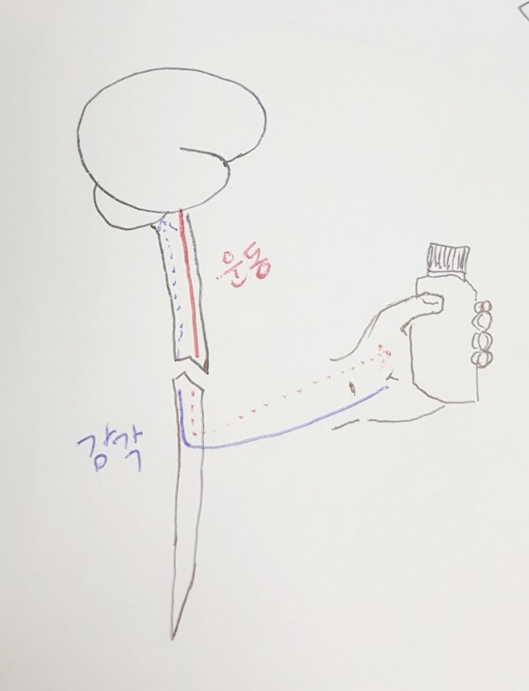 [chapter 7] 척수 손상의 원인 마비의 종류와 손상 정도 알아보기 네이버 블로그