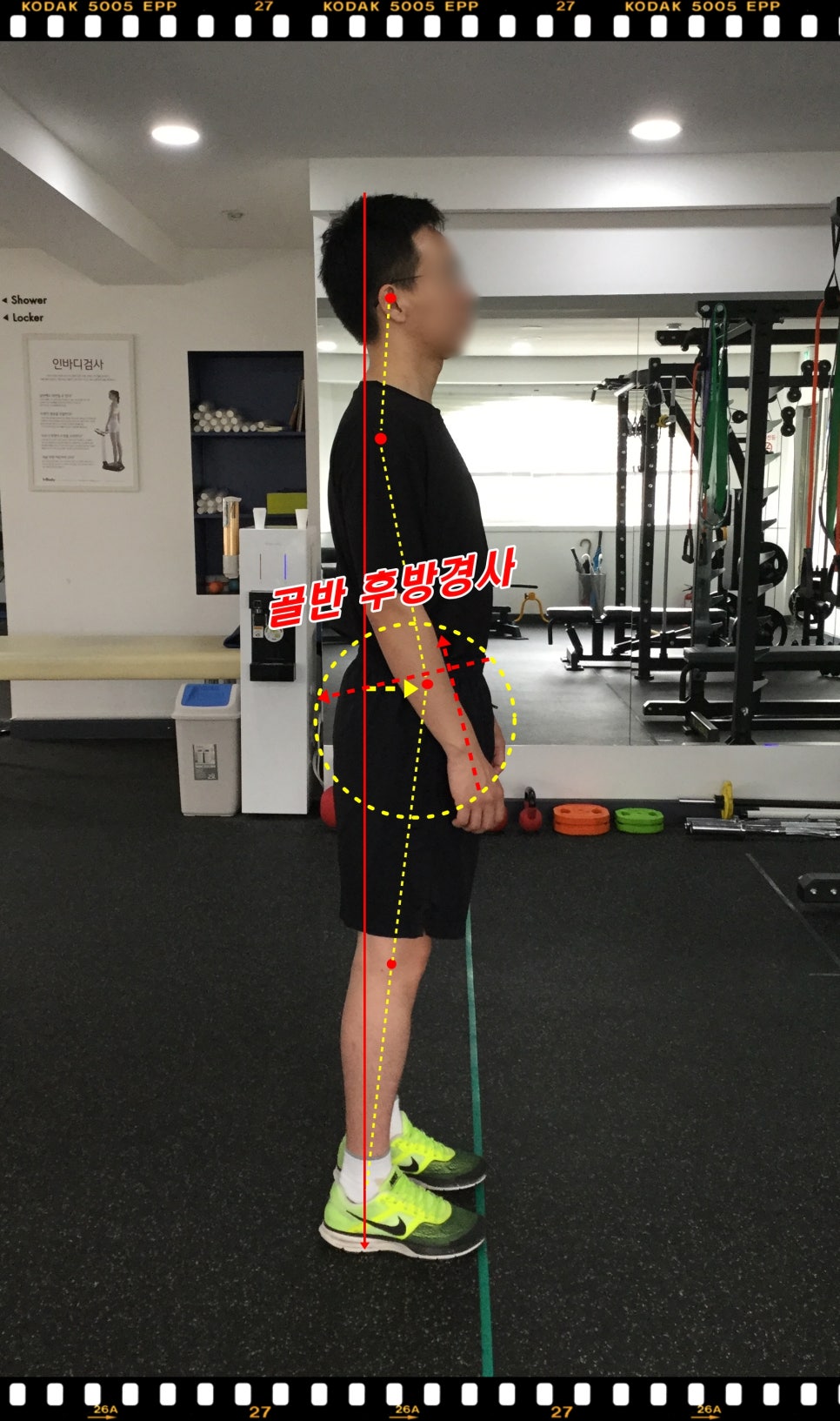 골반후방경사 햄스트링단축 장요근장골근긴장 양반다리제한 쪼그려앉기제한 데드리프트 레그컬 방배동헬스피티 반포헬스피티 방배동카페골목