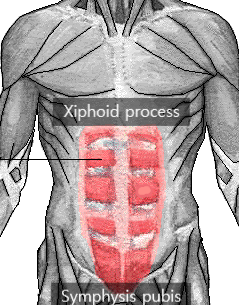 비버징후(Beevor's Sign) : 네이버 블로그