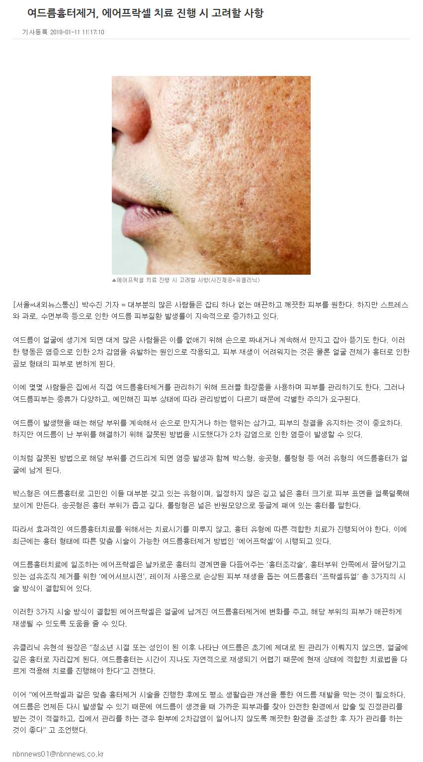 여드름흉터제거 유클리닉 에어프락셀 치료 진행 시 고려할 사항 네이버 블로그
