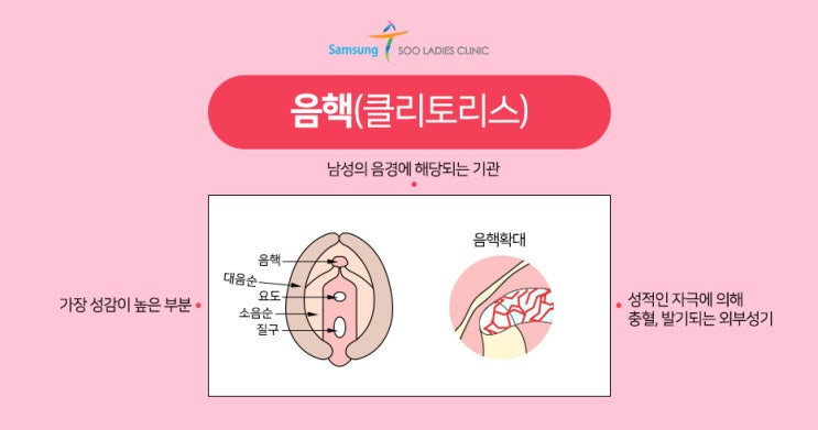 음핵수술 여성성형 전후 효과 네이버 블로그