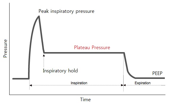 Plateau pressure와 Inspiratory Flow Rate : 네이버 블로그