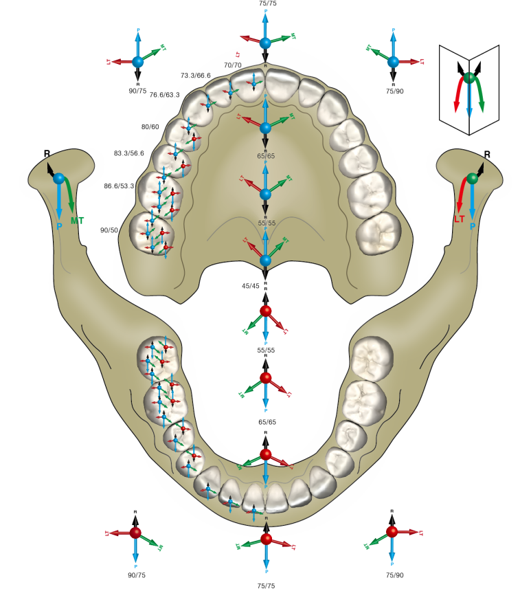 Gothic arch tracing : 네이버 블로그