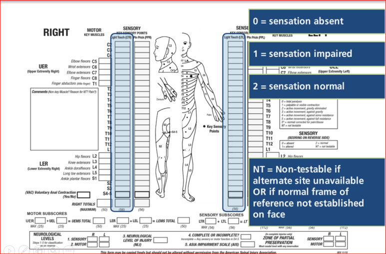 ISNCSCI 쉽게 이해하기(ASIA scale) - #3 Sensory, Motor level & NLI of SCI ...