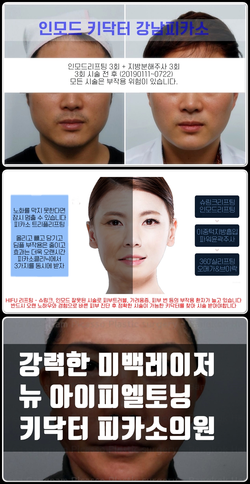 인모드리프팅 가격 멍 붓기 슈링크 인모드레이저 부작용 확인 네이버 블로그