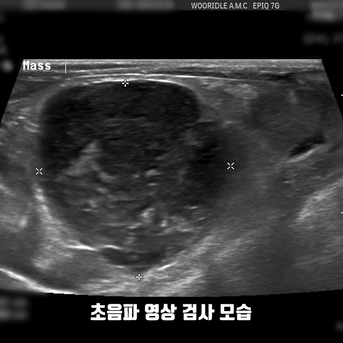 15살 푸들 강아지 비장종양 증상 수술 노령견 종양 Ct검사 네이버 블로그