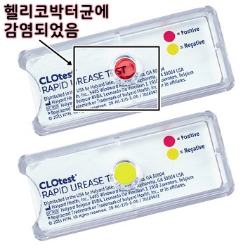 요소호기검사 CLO TEST 목적 방법 비용 등 간호사가 정리 : 네이버 블로그