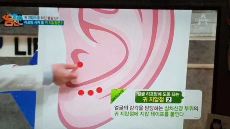 귀지압점 얼굴 리프팅에 도움되는 귀침 팔자주름 턱처짐 완화 네이버 블로그