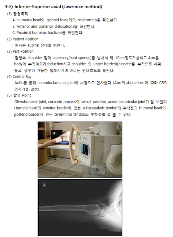 #방사선촬영법 #X-ray촬영법 #방사선촬영포지션 #엑스레이촬영법 #엑스레이촬영포지션 : 네이버 블로그
