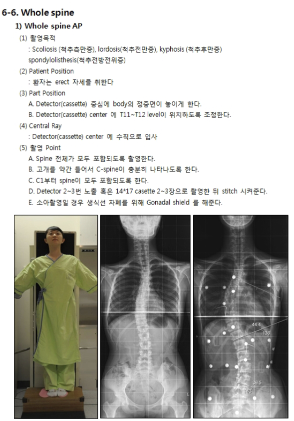 #방사선촬영법 #X-ray촬영법 #방사선촬영포지션 #엑스레이촬영법 #엑스레이촬영포지션 : 네이버 블로그