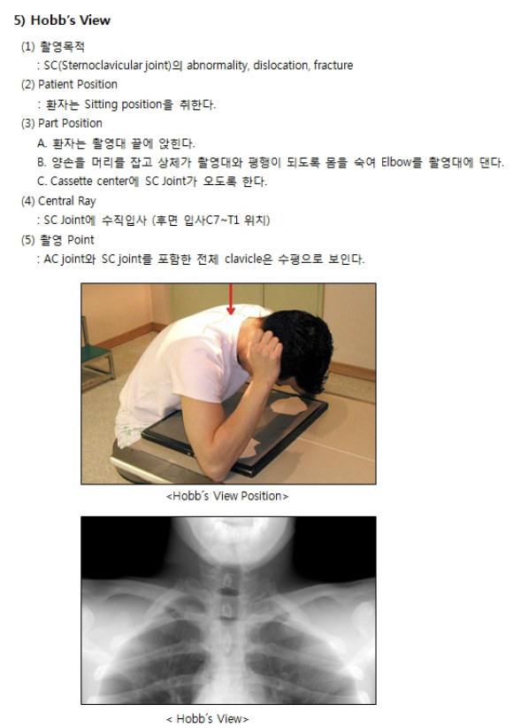 #방사선촬영법 #X-ray촬영법 #방사선촬영포지션 #엑스레이촬영법 #엑스레이촬영포지션 : 네이버 블로그