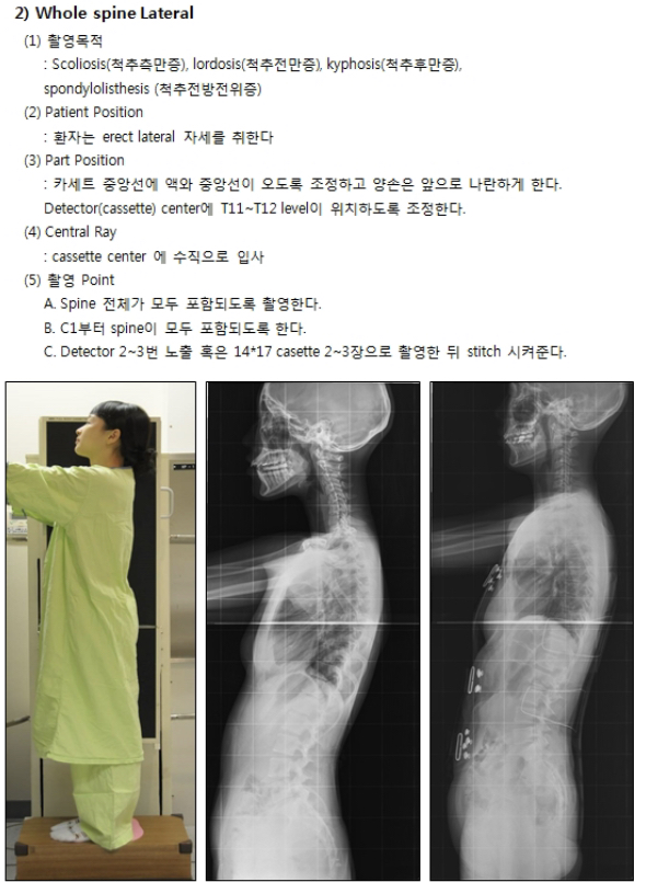 #방사선촬영법 #X-ray촬영법 #방사선촬영포지션 #엑스레이촬영법 #엑스레이촬영포지션 : 네이버 블로그