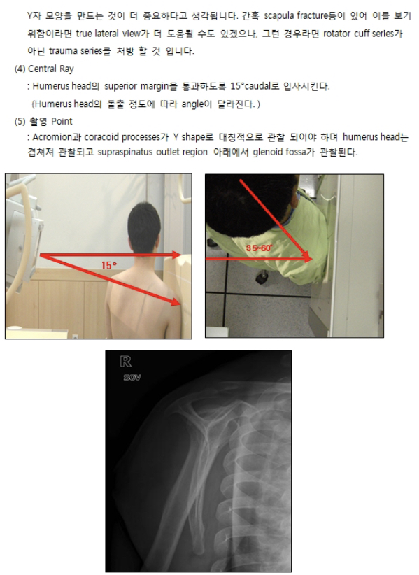 #방사선촬영법 #X-ray촬영법 #방사선촬영포지션 #엑스레이촬영법 #엑스레이촬영포지션 : 네이버 블로그