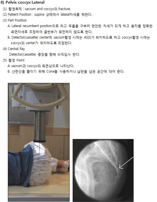 #방사선촬영법 #X-ray촬영법 #방사선촬영포지션 #엑스레이촬영법 #엑스레이촬영포지션 : 네이버 블로그