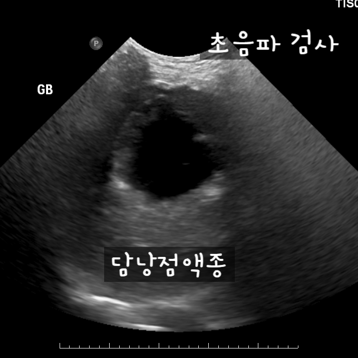 19살 노령견 강아지 담낭 제거 수술 담낭점액종 치료 네이버 블로그