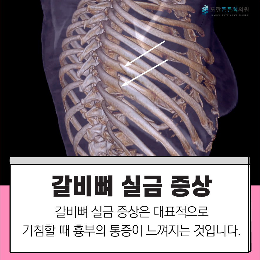 기침 갈비뼈 통증 재채기할때 갈비뼈실금 증상 네이버 블로그