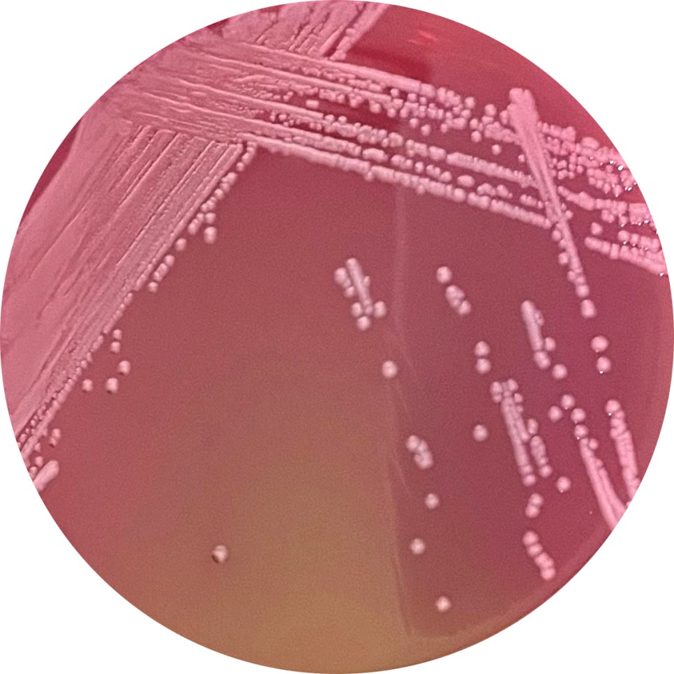 살모넬라(Salmonella.spp) 식품공전 실험방법(배지사용) : 네이버 블로그
