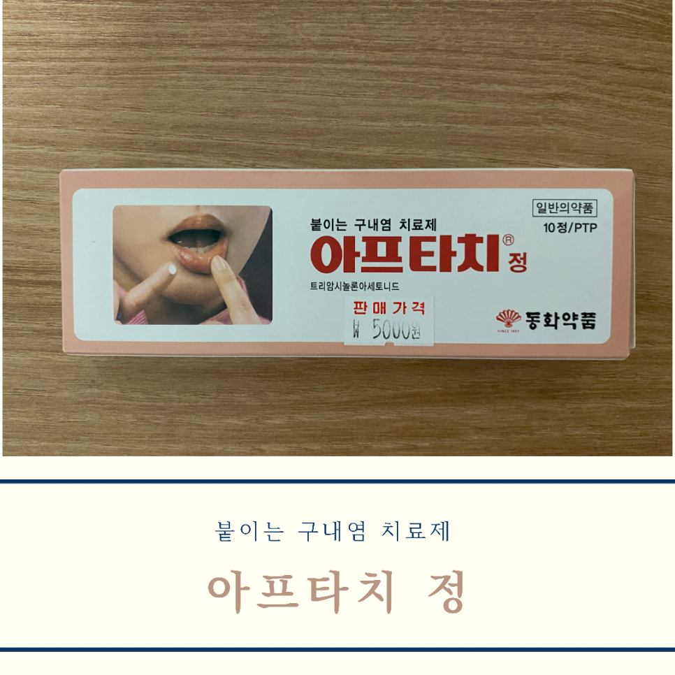 구내염 잇몸 입병 아프타치정으로 광명찾은 후기 Feat 알보칠 필요없다♥️ 네이버 블로그