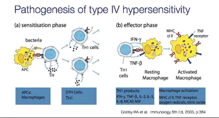 오래가는 충혈, 낫지 않는 결막염일 때는 '플릭텐각결막염(Phlyctenulosis), 플릭텐(Phlycten)'을 의심해보자 ...