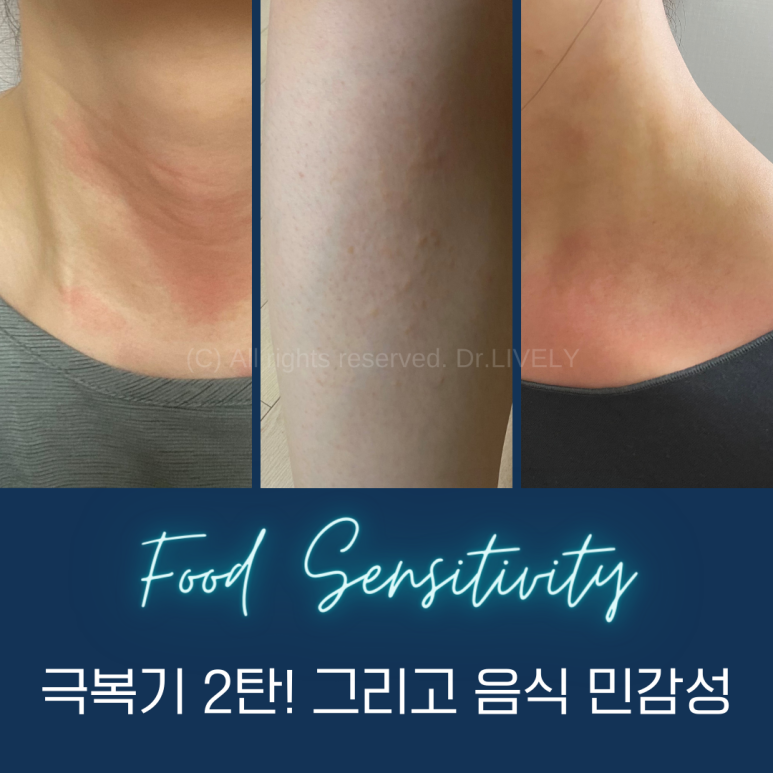 닥터 라이블리와 함께하는 건강이야기 네이버 블로그