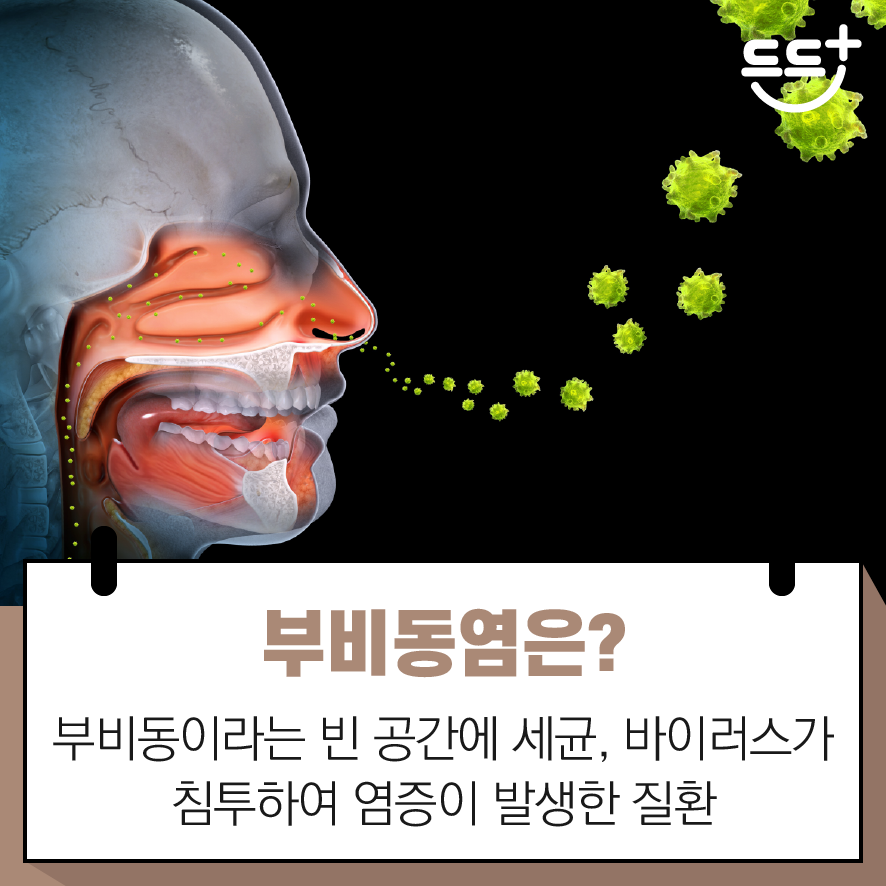 답답한 코막힘 코 뒤로 넘어가는 콧물 증상인 축농증 부비동염 두통 증상 네이버 블로그