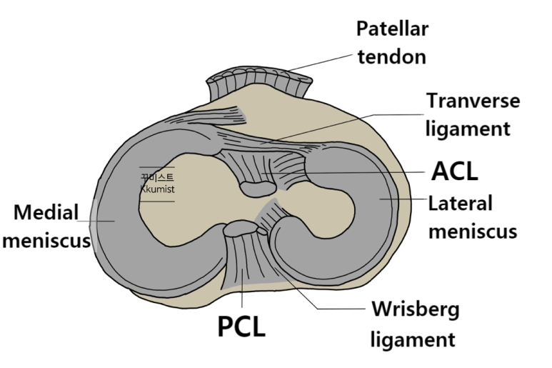 ACL 검사 라크만 테스트(Lachman Test), 전방십자인대 파열과 원인 그리고 예방법 : 네이버 블로그
