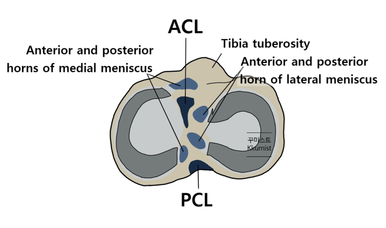 ACL 검사 라크만 테스트(Lachman Test), 전방십자인대 파열과 원인 그리고 예방법 : 네이버 블로그