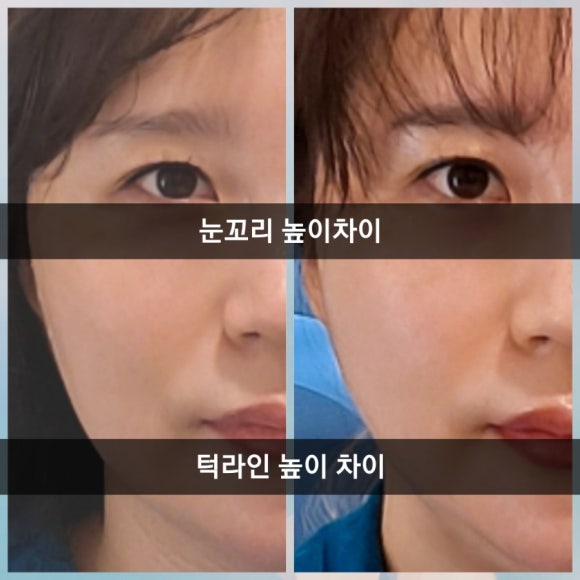 강남대치동피부관리 에스테티아 대치 1호점에서 손맛 장인에게 윤곽관리 받고 온 후기 네이버 블로그