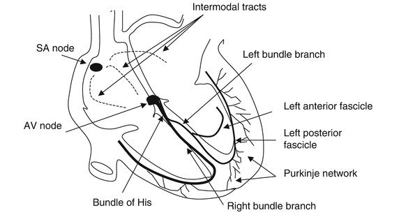 심전도 공부 - Left bundle branch block (LBBB) : 네이버 블로그