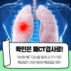 간유리 음영 폐결절 폐암 초기증상일까 네이버 블로그