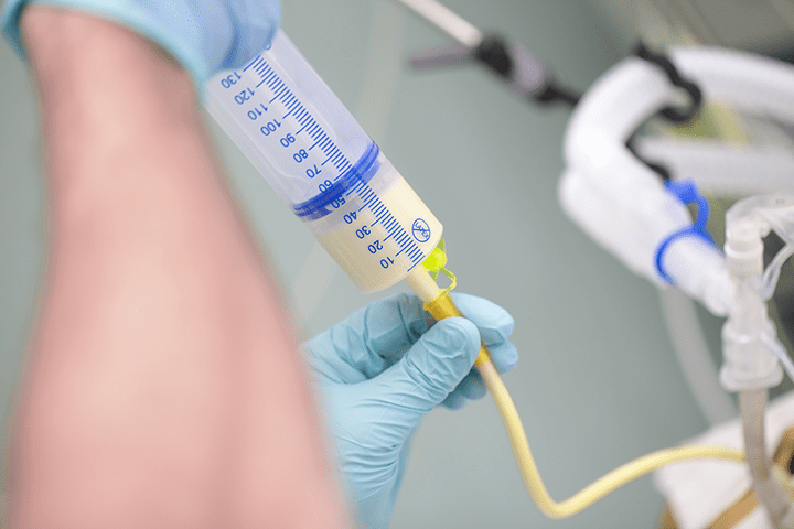 L-tube feeding 경관영양 방법, 자세, 관류, 잔류량, 순서, 합병증, 비위관 삽입 방법 : 네이버 블로그