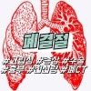 고립성 폐결절 증상 및 수술 흉부 전선량 폐 Ct 네이버 블로그