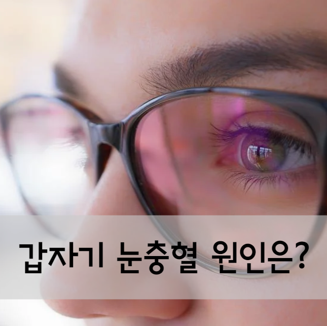 갑자기 눈충혈이유는 눈충혈원인 7가지 네이버 블로그