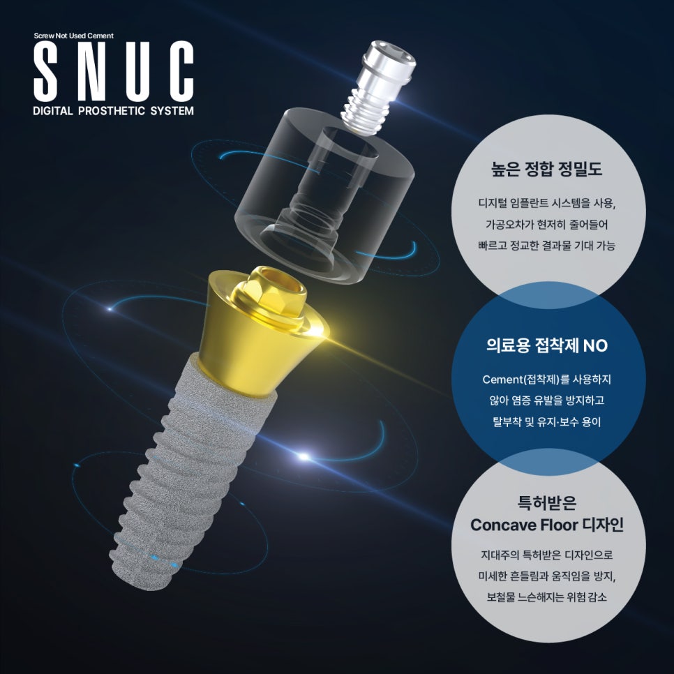 세멘리스(Cementless)보철, SNUC를 선택해야 하는 이유! ② : 네이버 블로그