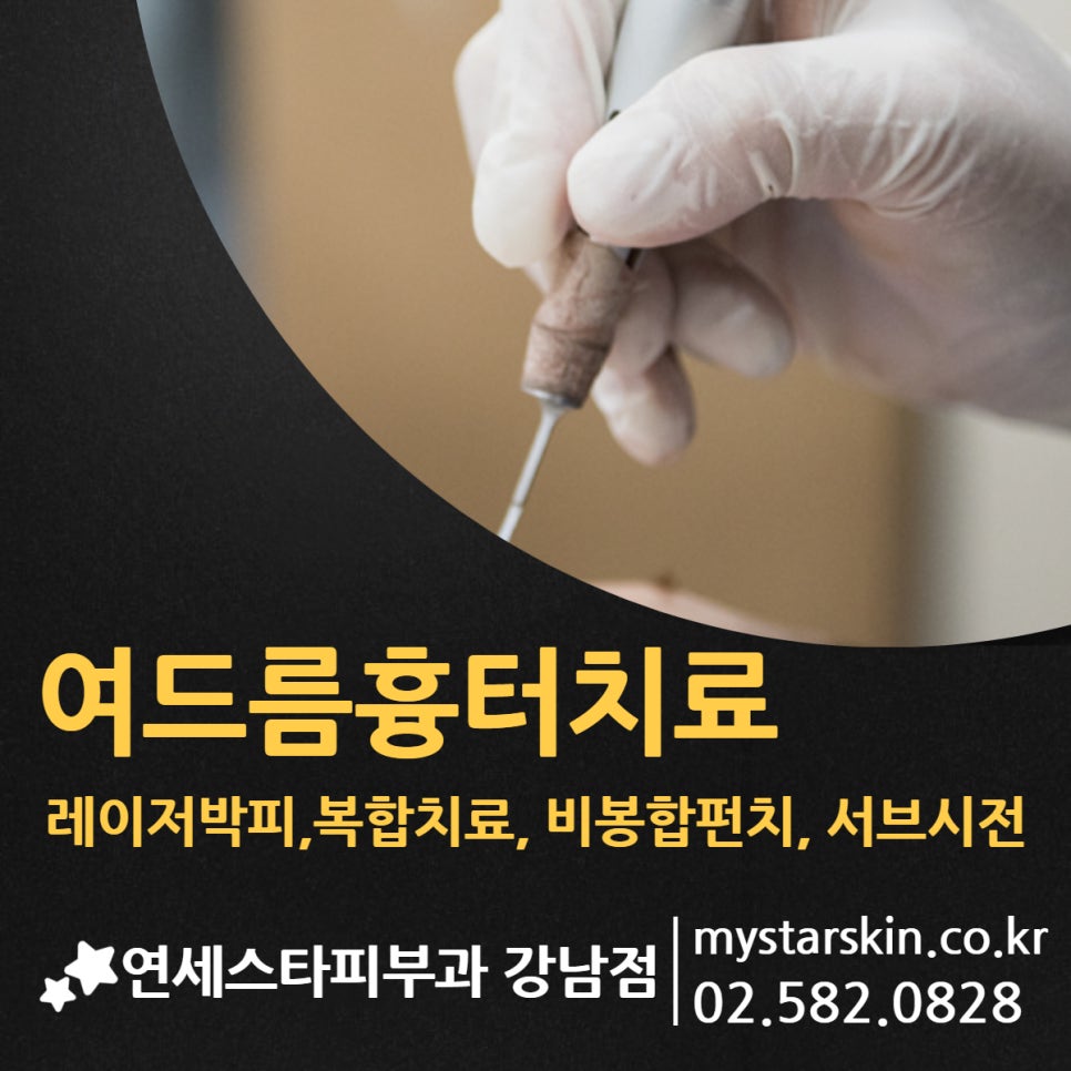 연세스타피부과 강남점 치료 기간을 대폭 단축시킨 여드름흉터 치료법 비봉합펀치술 네이버 블로그