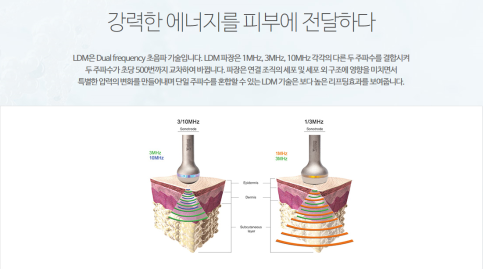 LDM 물방울 리프팅 - 효과와 시술 후 주의사항, 통증, 시술 주기 정리 : 네이버 블로그