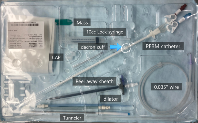 Perm catheter Procedure(터널식 투석도관 삽입술)-장기목적용 : 네이버 블로그