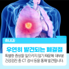 건강검진에서 발견된 폐결절이란 작은 폐결절까지 Ct 검사를 통해 진단 네이버 블로그