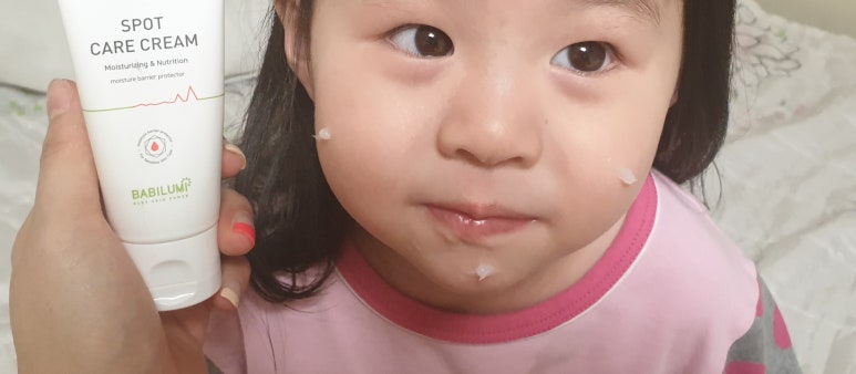 얼굴동전습진 아기피부염 확실히 관리해줘요 네이버 블로그