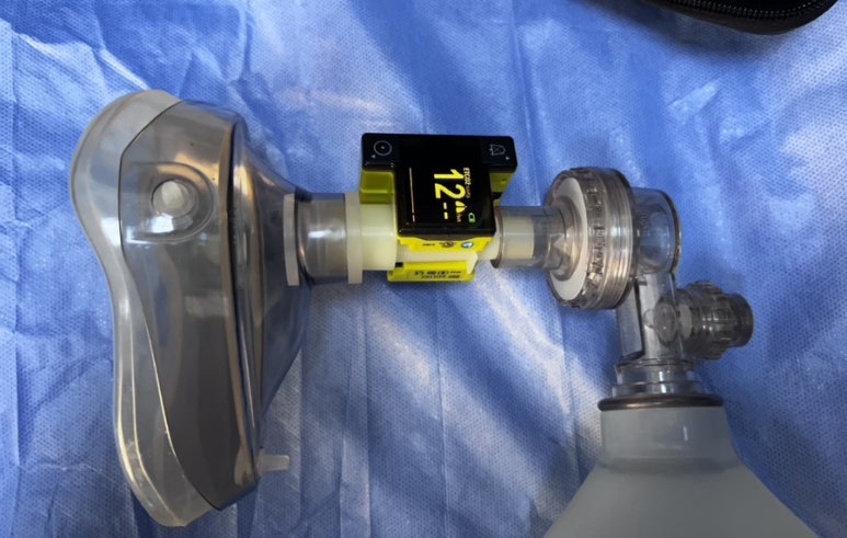 Etco2(호기말 이산화탄소)-Masimo EMMA : 네이버 블로그