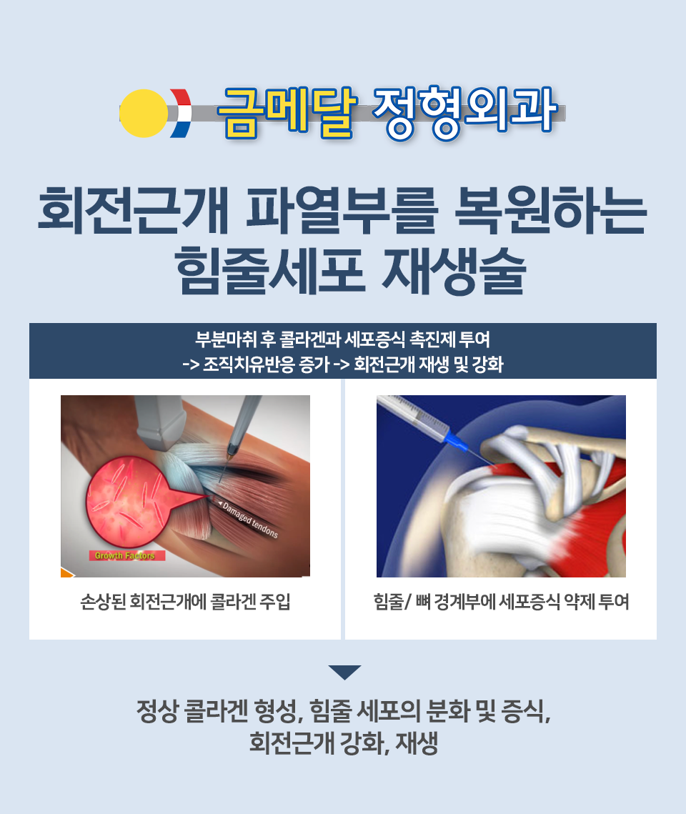 어깨통증병원 어깨회전근개파열 증상 의심되는 즉시 네이버 블로그