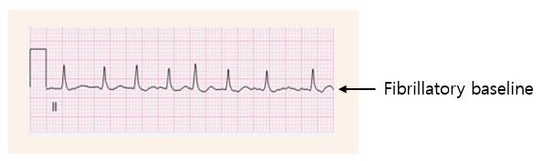 심방세동 총정리 atrial fibrillation, 의학용어 AF, Afib, Paroxysmal, Persistent 정의 ...