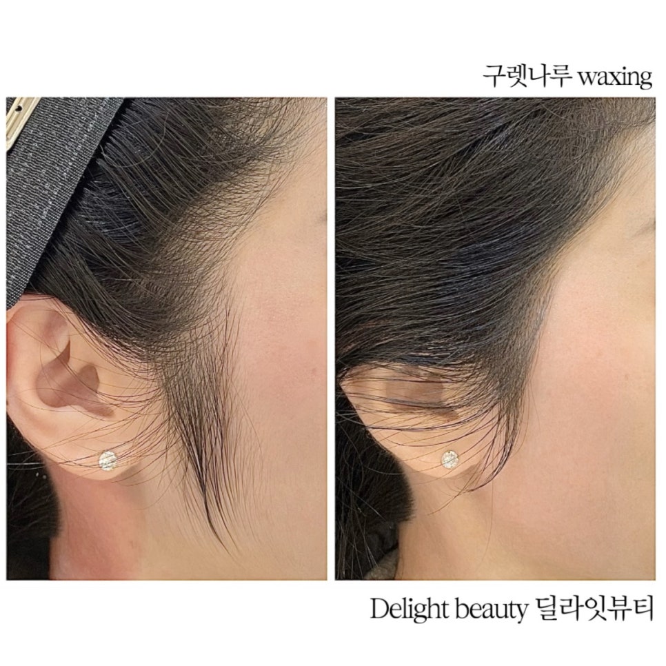 익산왁싱 여자 구렛나루 왁싱 잘하는 곳 무성히 자라버린 털들 마치 없었던 것처럼 깔끔하게 라인 정리하기익산딜라잇뷰티