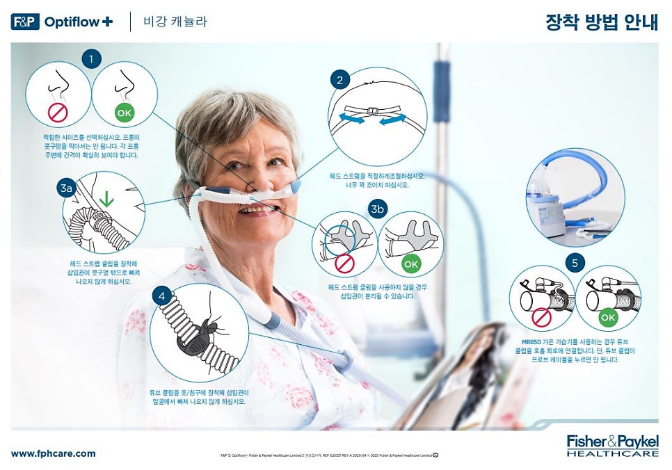 High Flow(고유량산소요법)적용 및 airvo 사용방법 알아보기 : 네이버 블로그