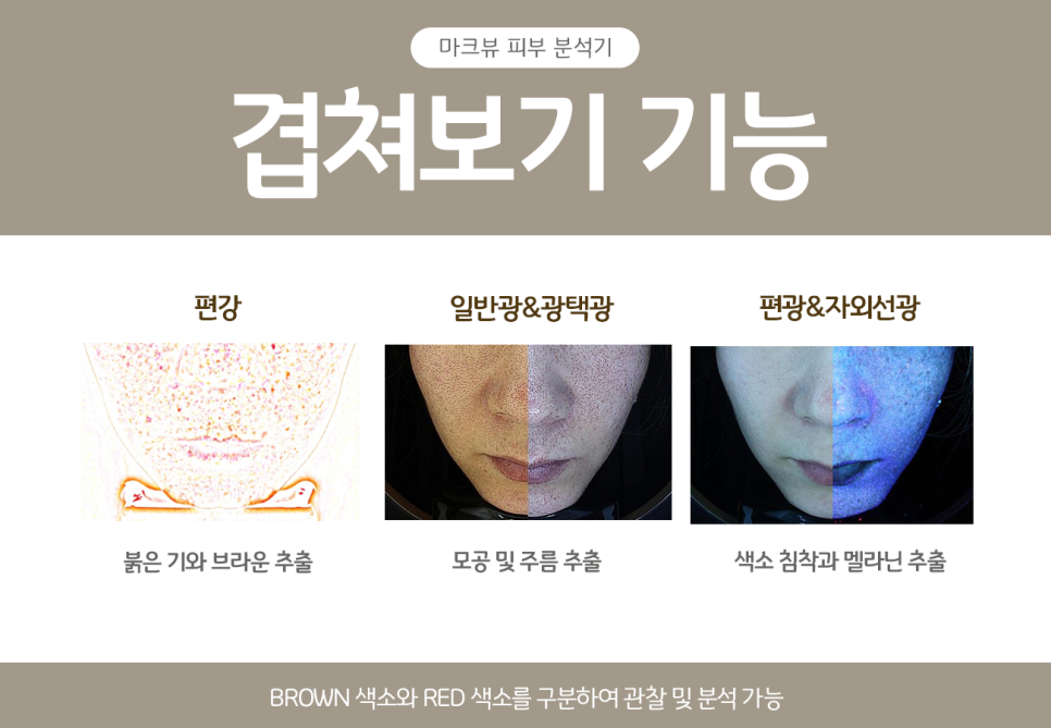 [마크뷰] 12가지 피부 상태 분석이 가능한 마크뷰(Mark-Vu) 피부 분석기! : 네이버 블로그