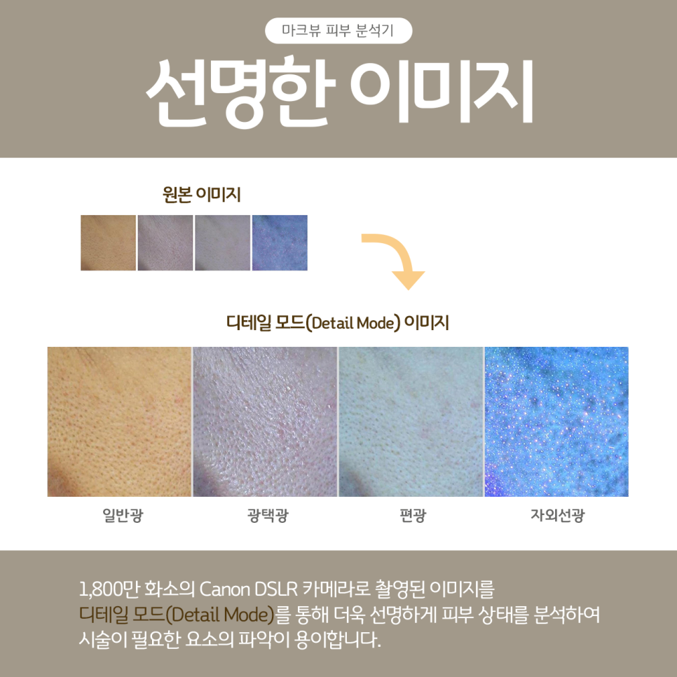 [마크뷰] 12가지 피부 상태 분석이 가능한 마크뷰(Mark-Vu) 피부 분석기! : 네이버 블로그