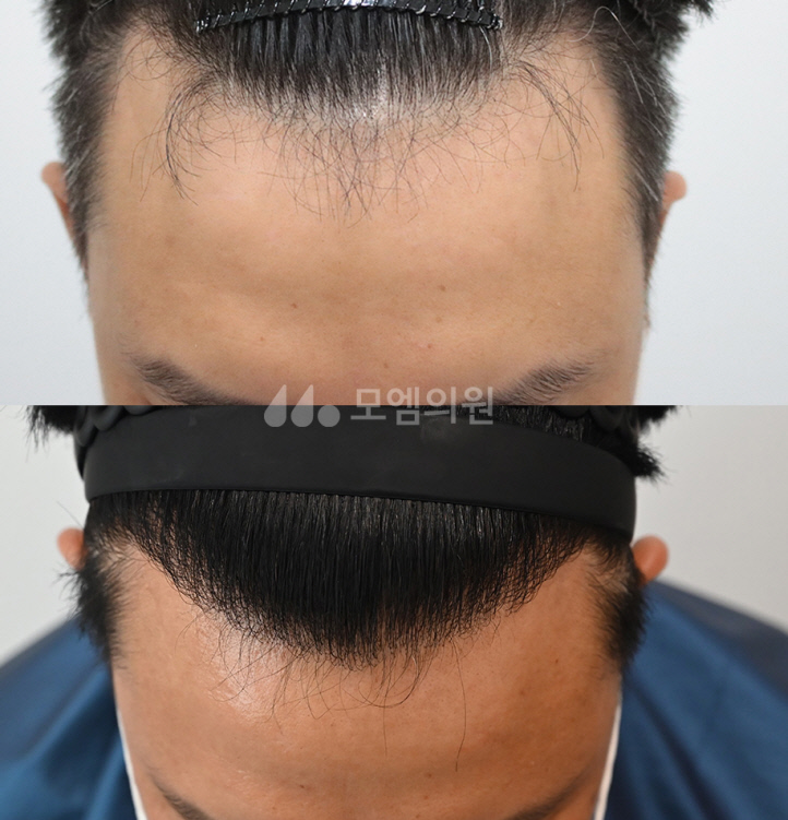 모엠의원 공식 블로그입니다 네이버 블로그