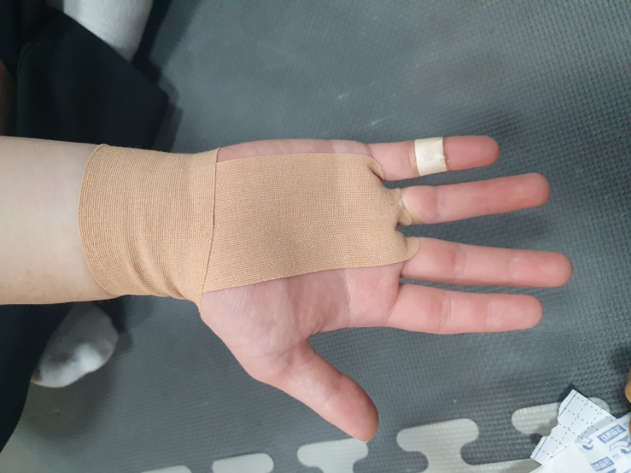클라이밍 운동 손바닥 물집으로 피부가 벗겨졌을 때 응급처치 방법 네이버 블로그